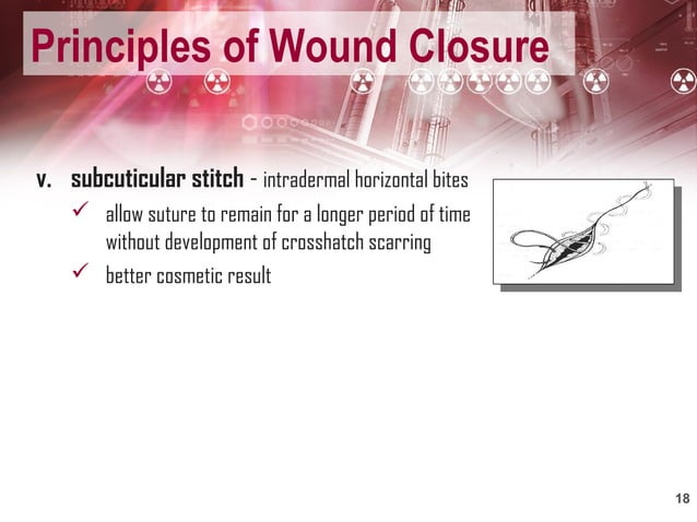 Principles of incision and wound closure | PPT