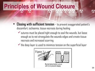 Principles of incision and wound closure | PPT