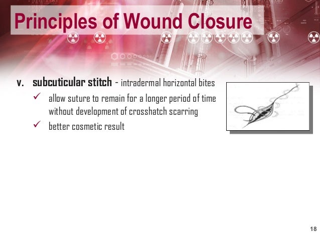 Principles of incision and wound closure