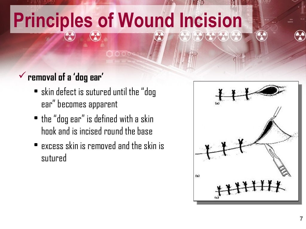 Principles of incision and wound closure
