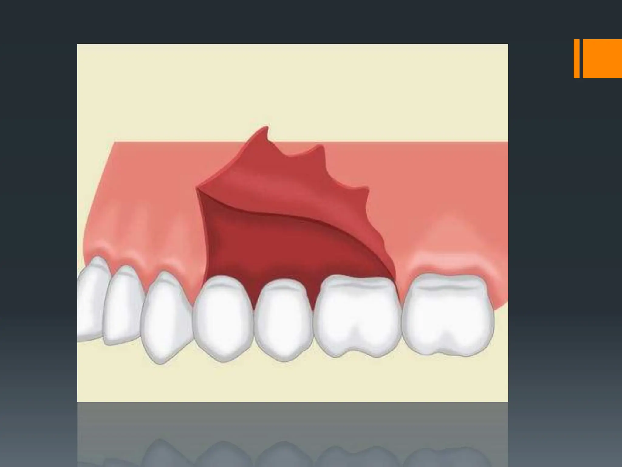 Principles of, incisions in oral surgery.ppt