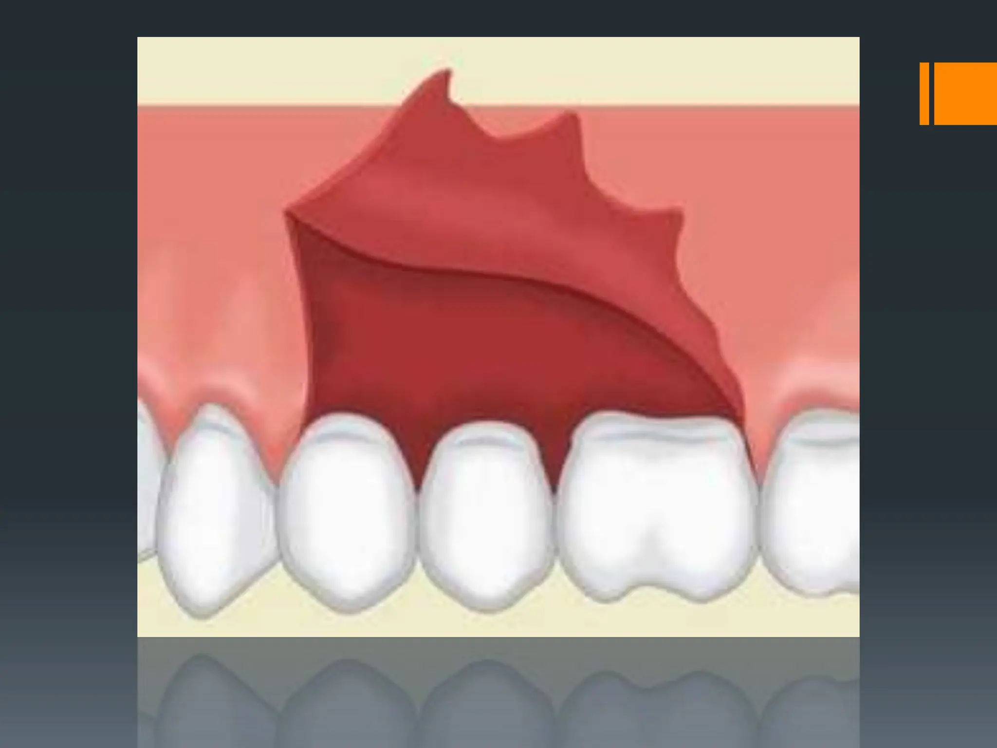 Principles of, incisions in oral surgery.ppt
