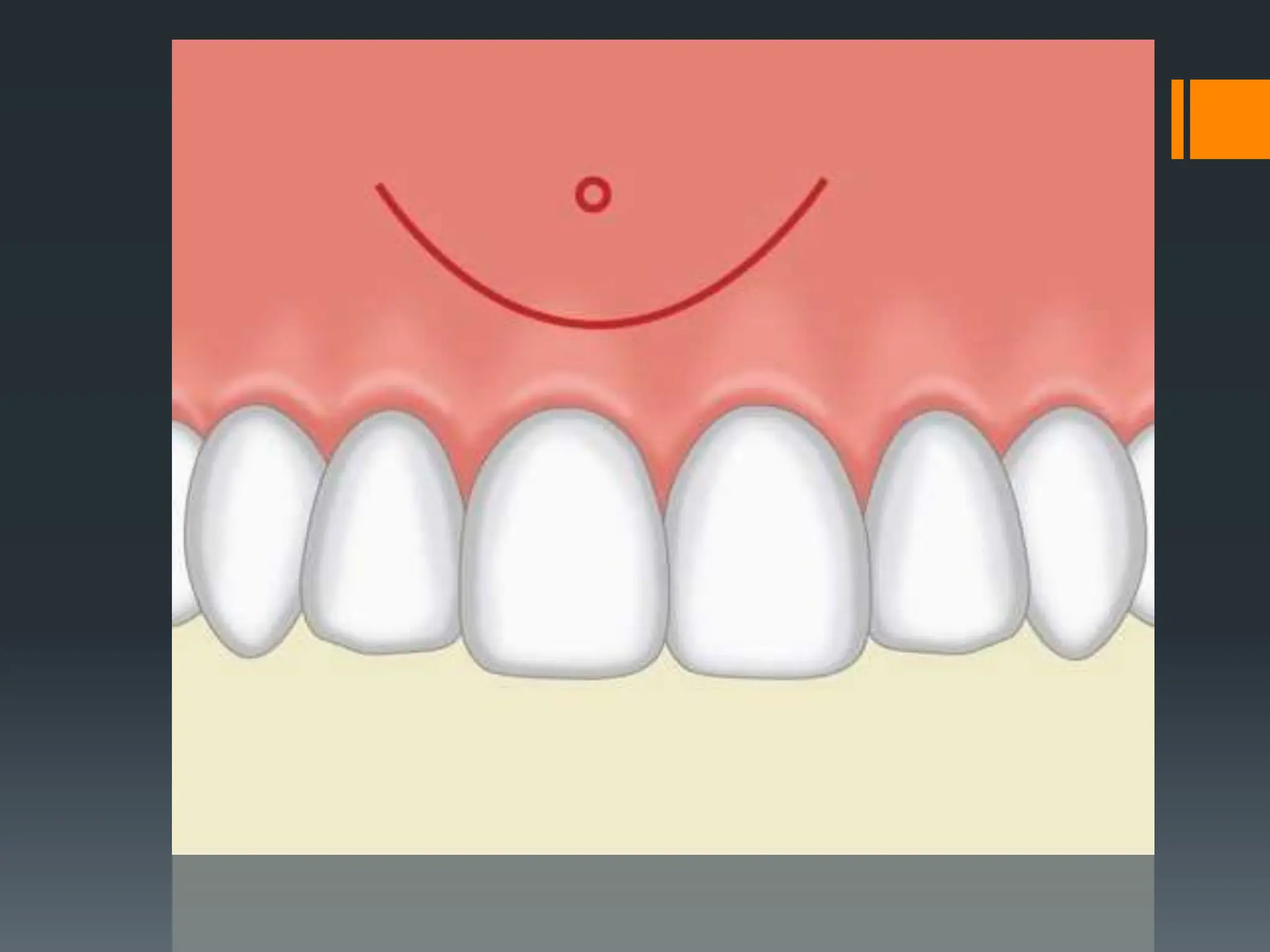 Principles of, incisions in oral surgery.ppt