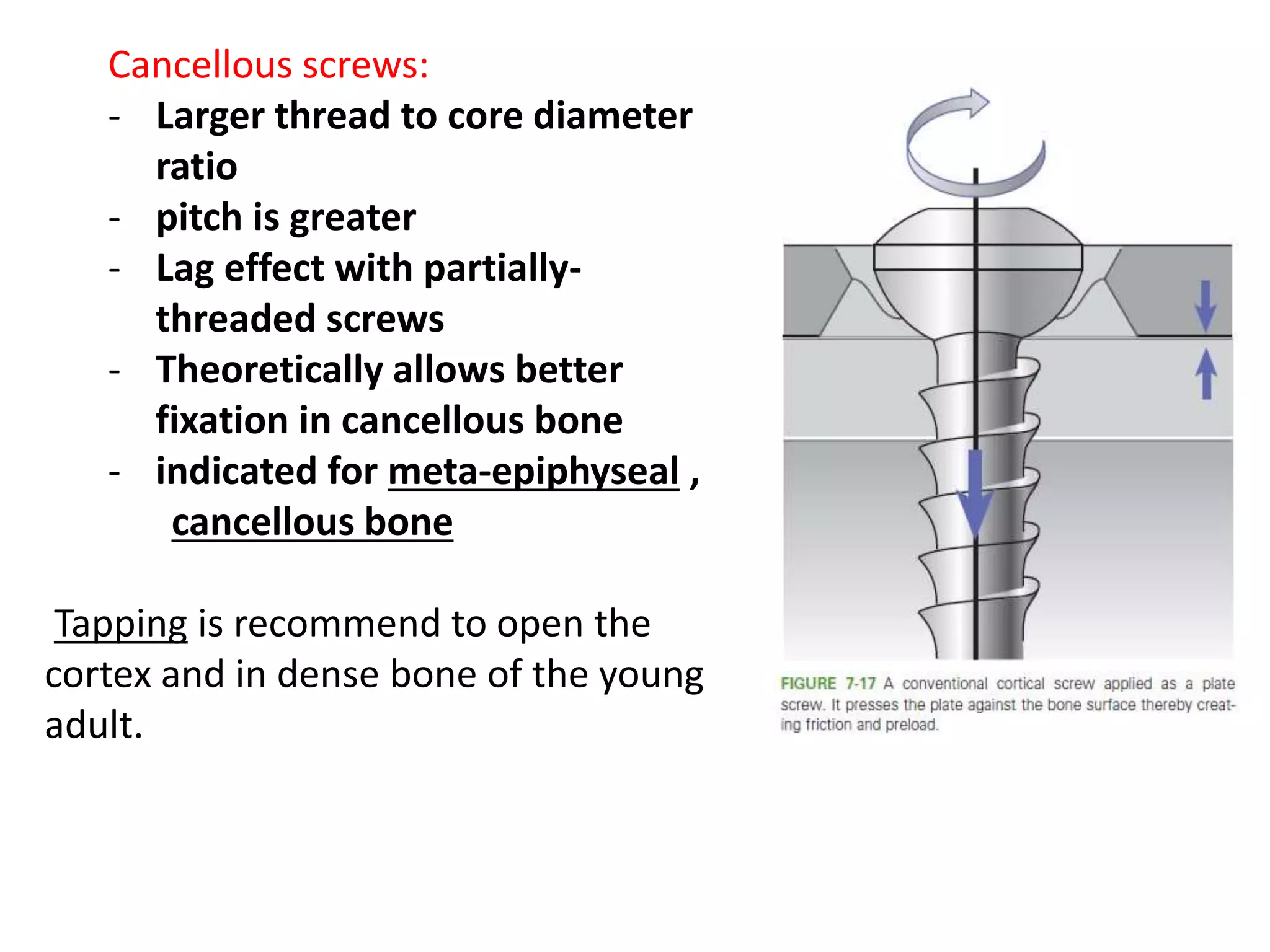 Principles of internal fixation | PPTX