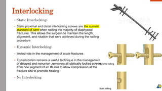 Principles of Internal Fixation.pptx