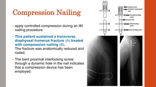 Principles of Internal Fixation.pptx