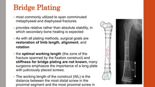 Principles of Internal Fixation.pptx