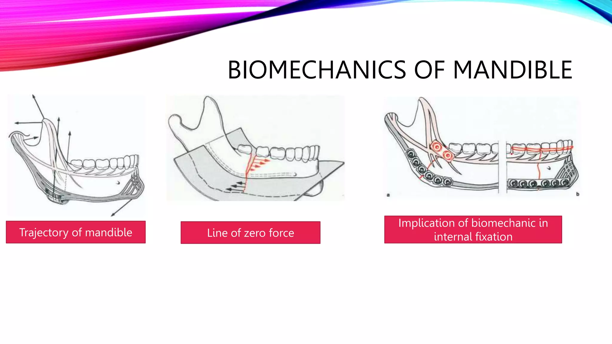 Principles of internal fixation.pptx