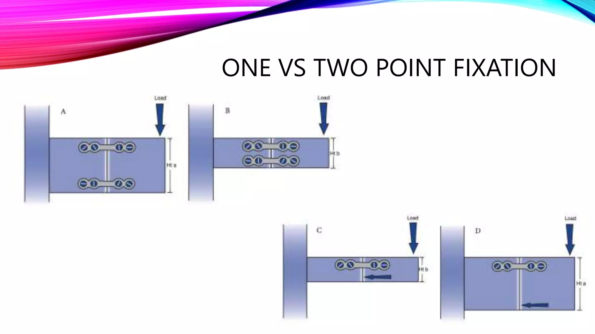 Principles of internal fixation.pptx