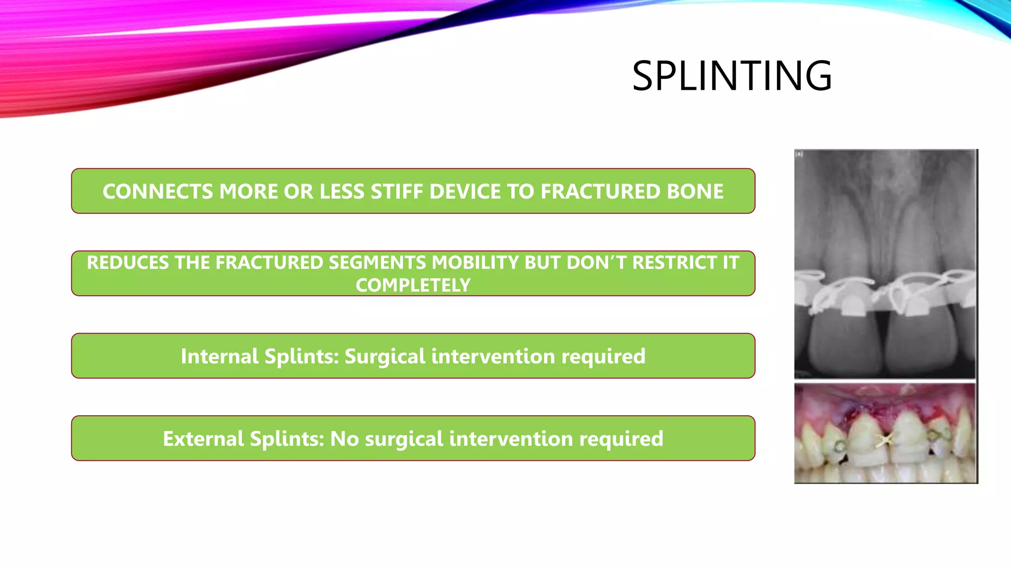 Principles of internal fixation.pptx