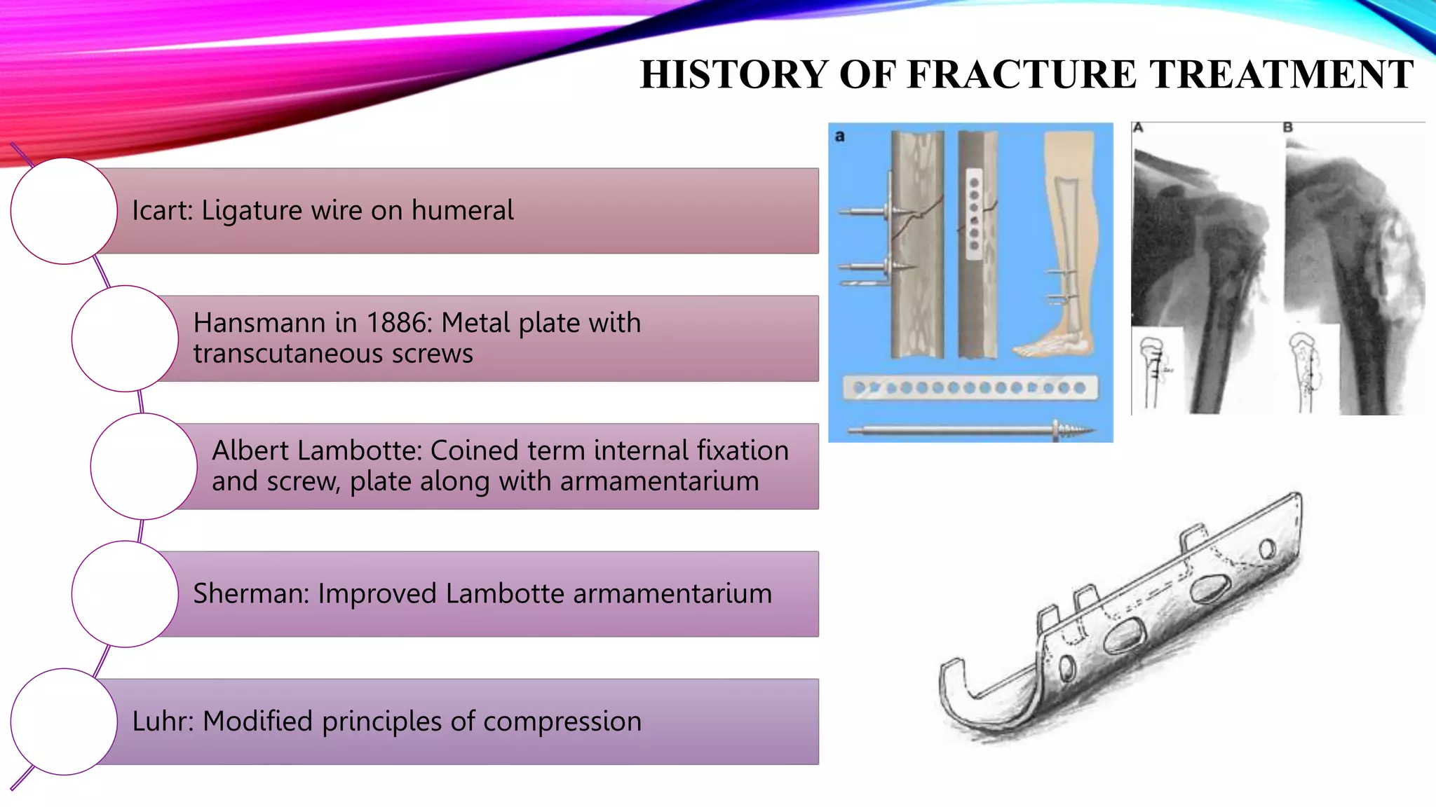 Principles of internal fixation.pptx