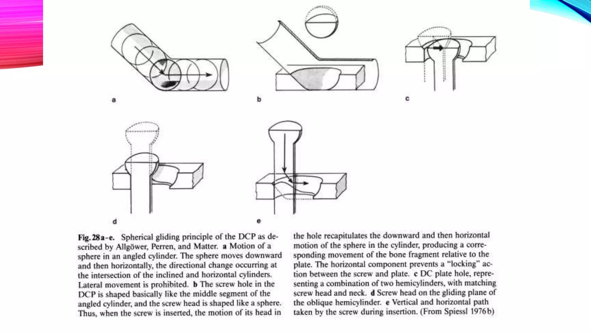 Principles of internal fixation.pptx
