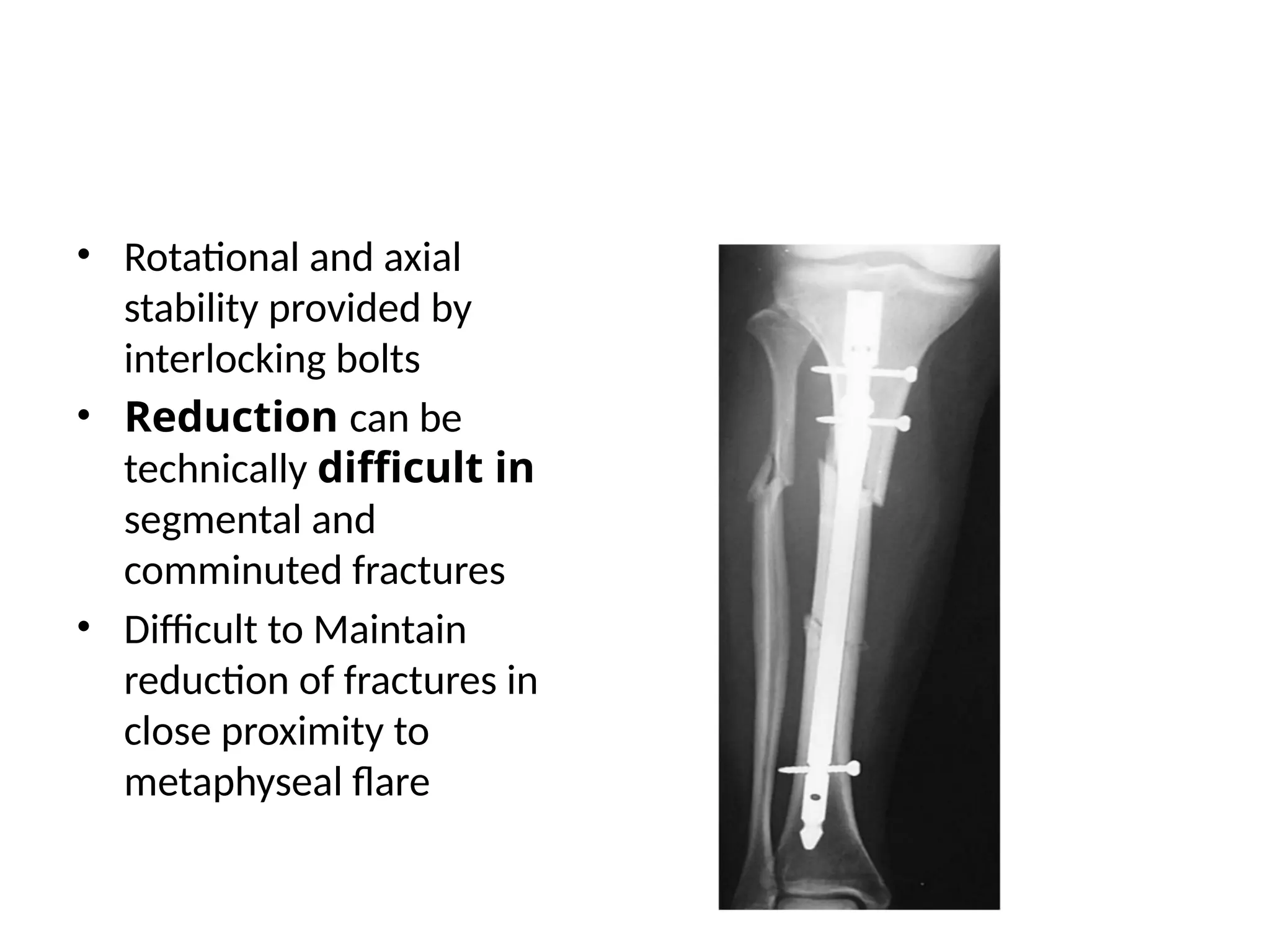 PRINCIPLES OF INTERNAL FIXATION NEW.pptx