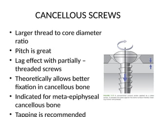 PRINCIPLES OF INTERNAL FIXATION NEW.pptx
