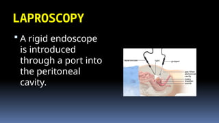 The Principles of laparoscopic surgery.pptx