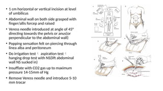 Principles of Laparoscopic Surgery(for minimal surgery).pptx