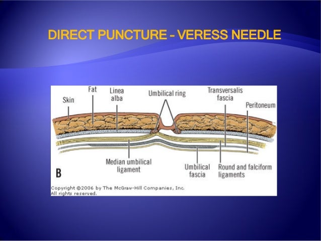 Principlesoflaparoscopy.1saudia (1)