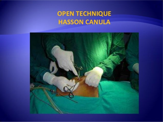 Principlesoflaparoscopy.1saudia (1)