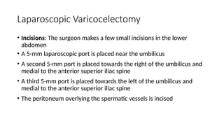 Principles of Laparoscopy and Procedure of Laparoscopic Varicocelectomy ...