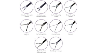 Principles of Laparoscopy and Procedure of Laparoscopic Varicocelectomy ...