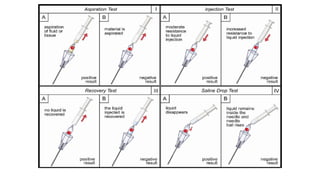 Principles of Laparoscopy and Procedure of Laparoscopic Varicocelectomy ...