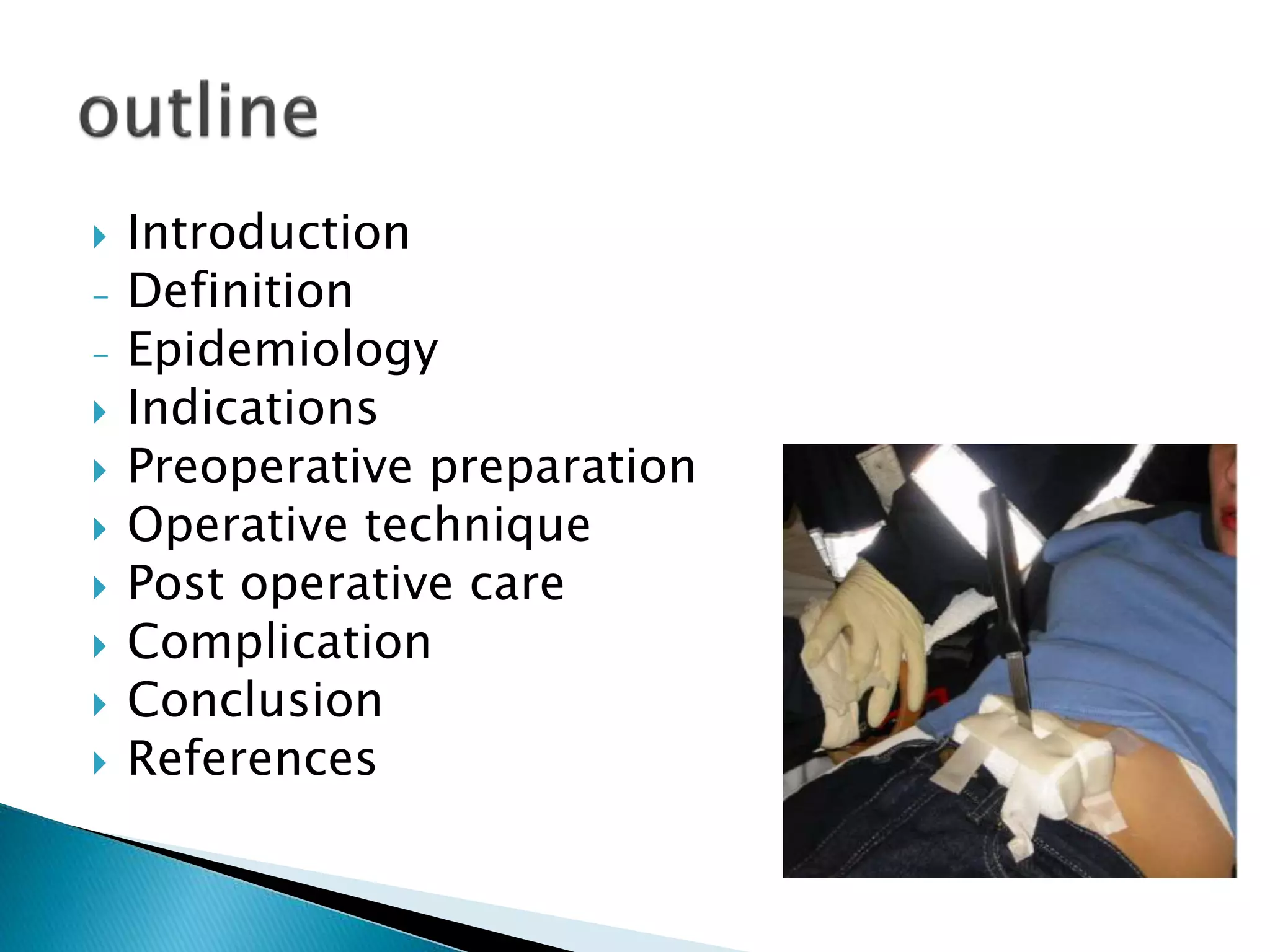 Principles of laparotomy for trauma | PPTX