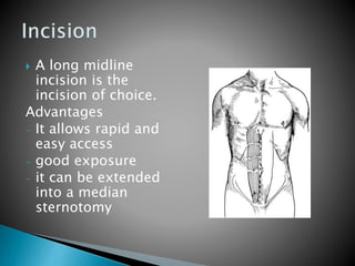 Principles of laparotomy for trauma | PPTX