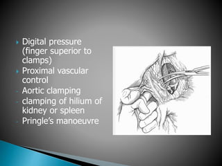 Principles of laparotomy for trauma | PPTX