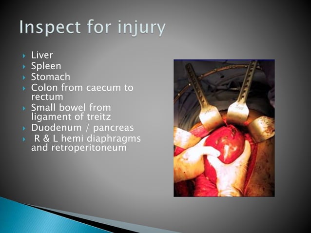 Principles of laparotomy for trauma | PPTX | First Aid | Injuries