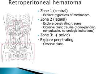 Principles of laparotomy for trauma | PPTX