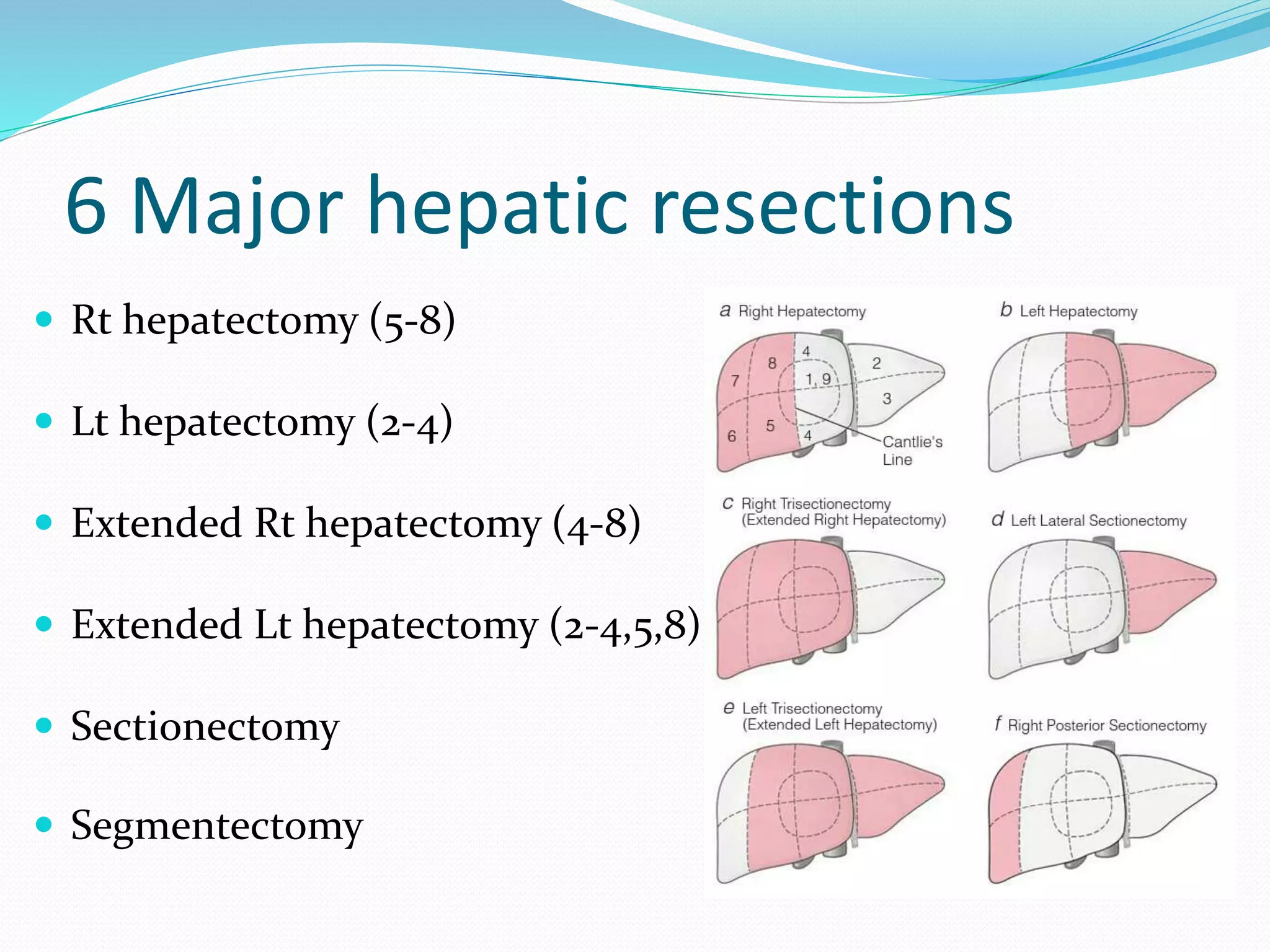 Principles of liver resection.pptx