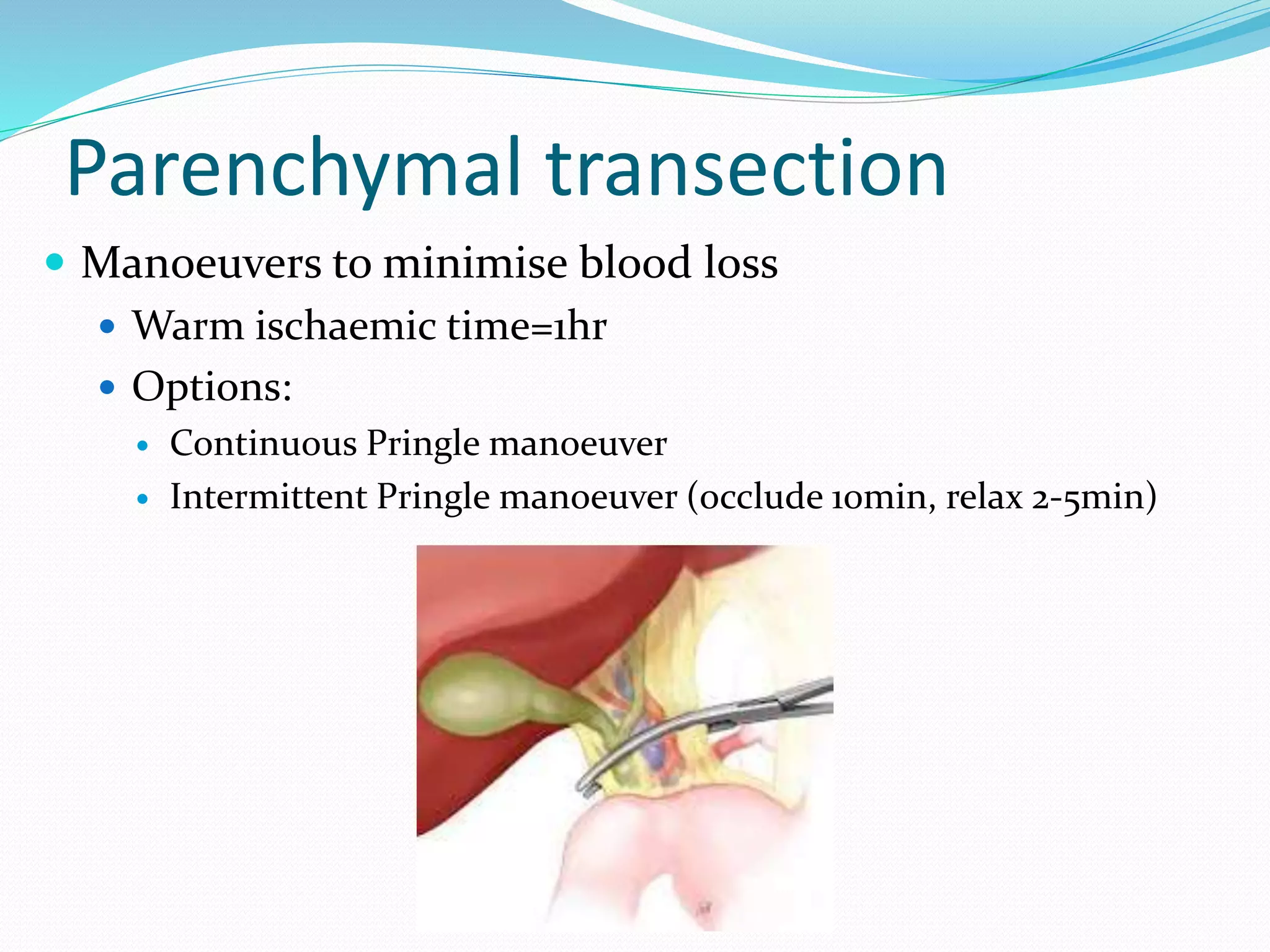 Principles of liver resection.pptx