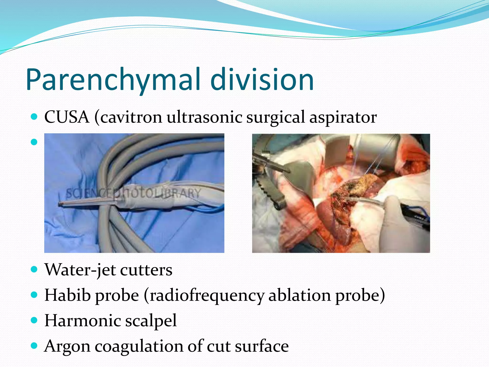 Principles of liver resection.pptx