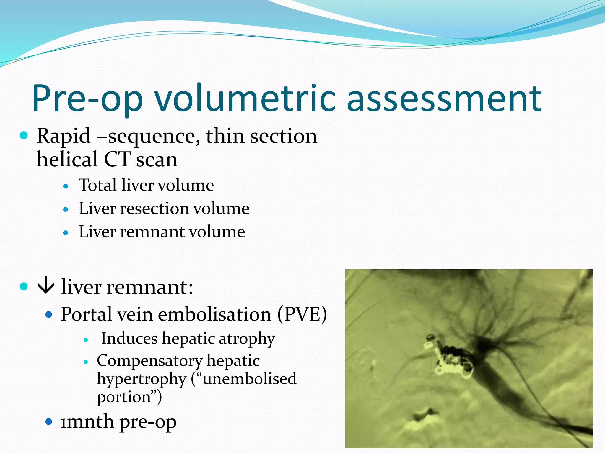 Principles of liver resection.pptx
