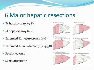 Principles of liver resection.pptx