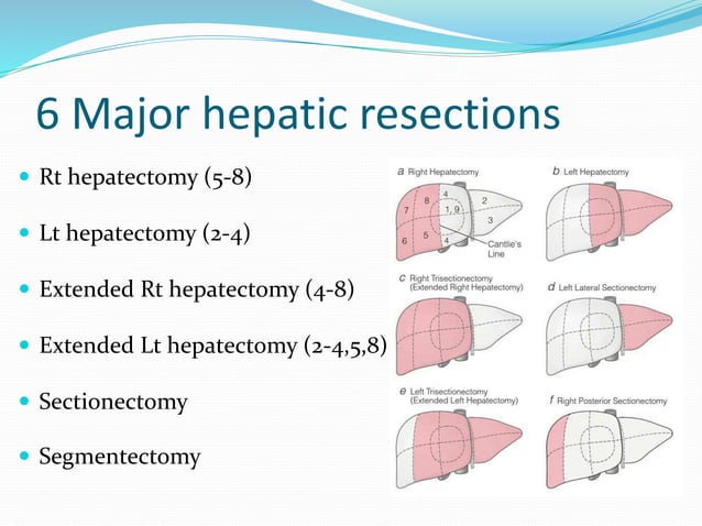 Principles of liver resection.pptx