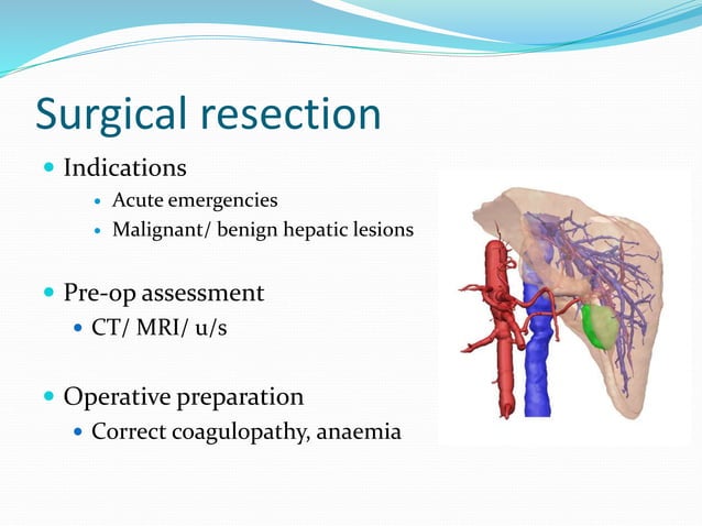 Principles of liver resection.pptx
