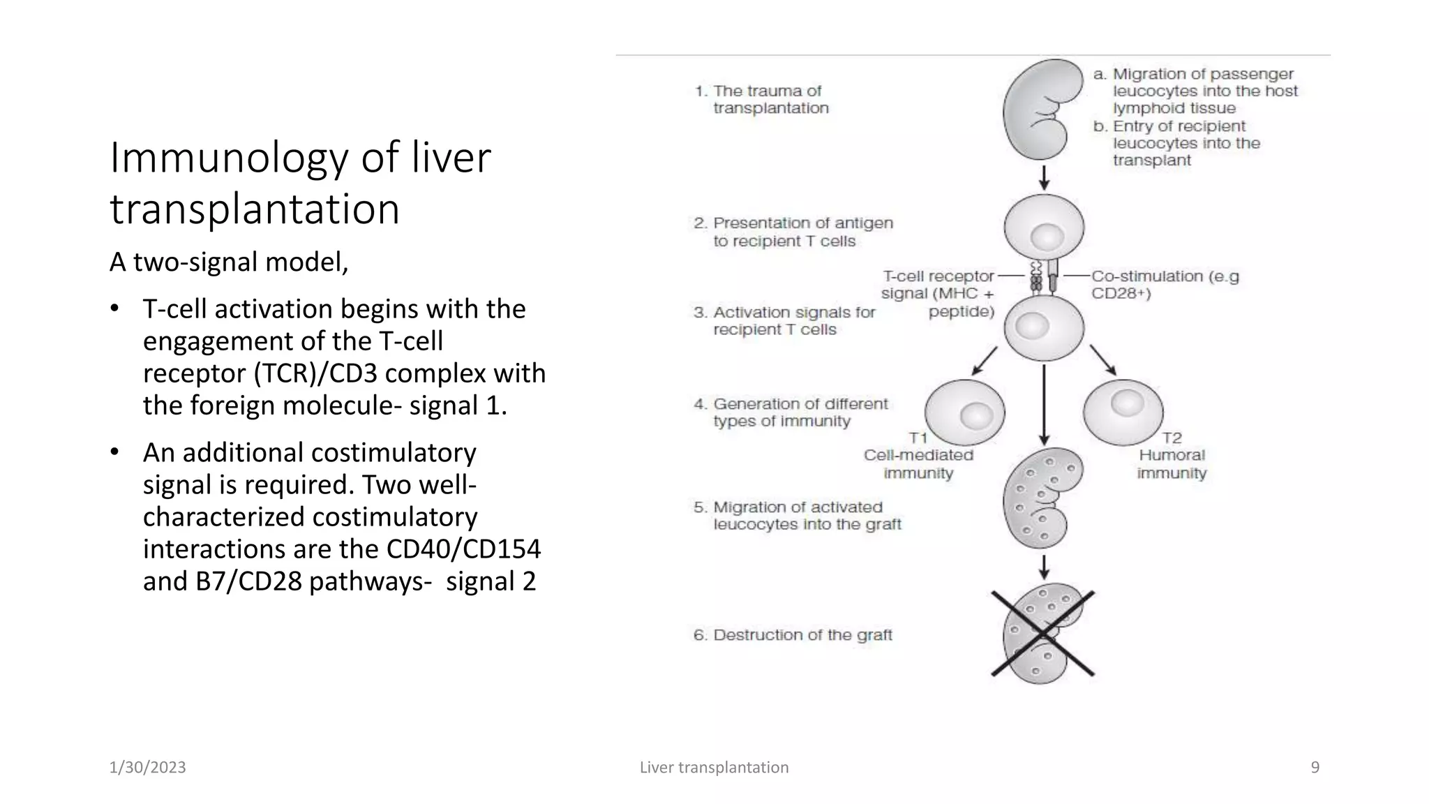 Principles of LIVER TRANSPLANTATION.pptx