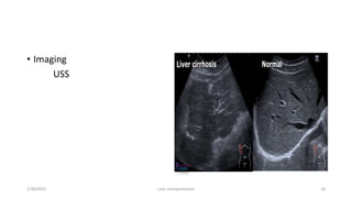 Principles of LIVER TRANSPLANTATION.pptx