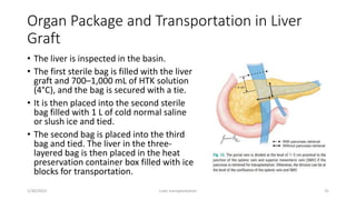 Principles of LIVER TRANSPLANTATION.pptx