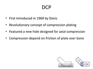 Principles of locking compression plates | PPTX