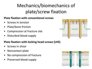 Principles of locking compression plates | PPTX