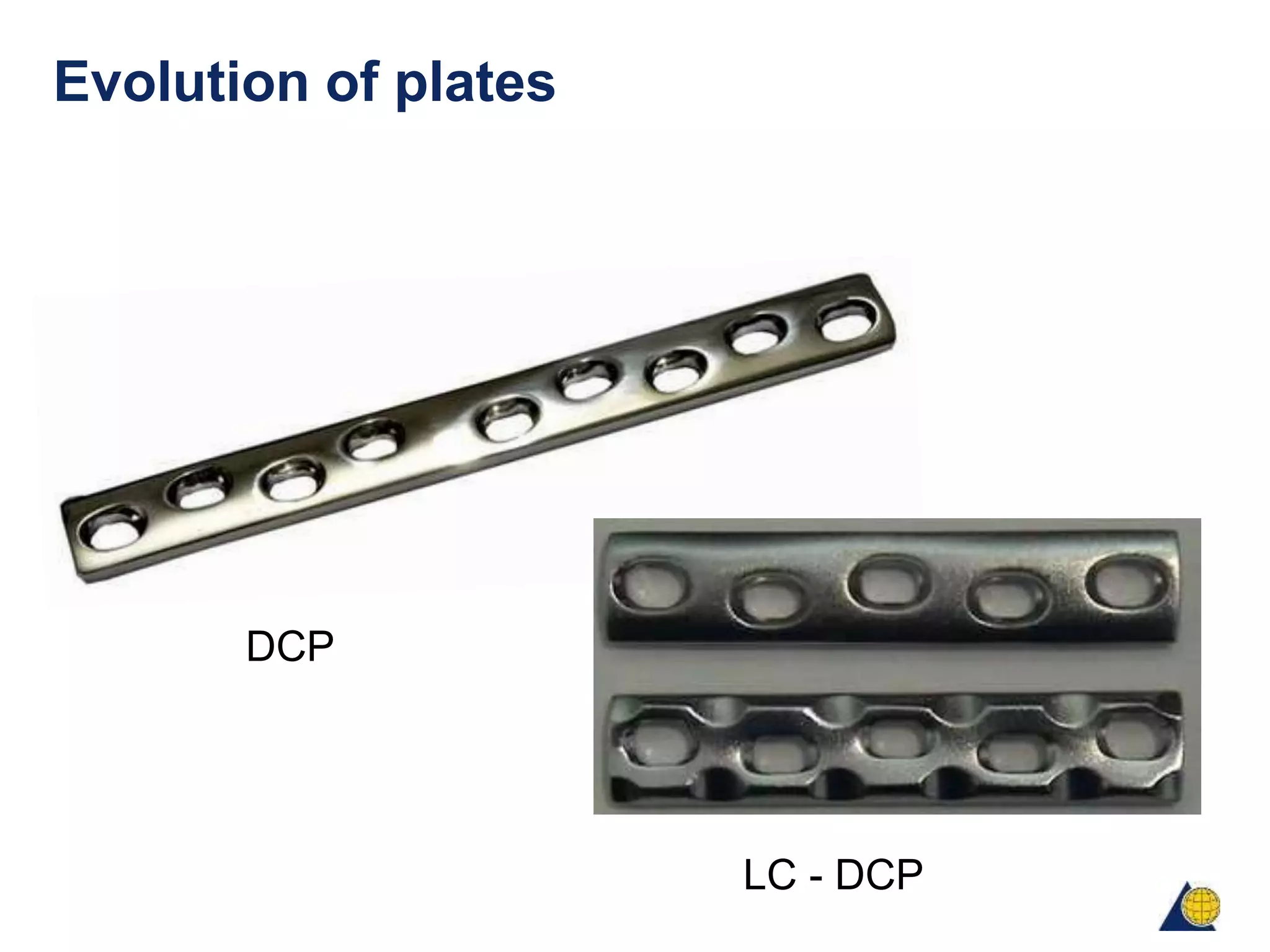 Principles of lock plate fixation AO | PPTX