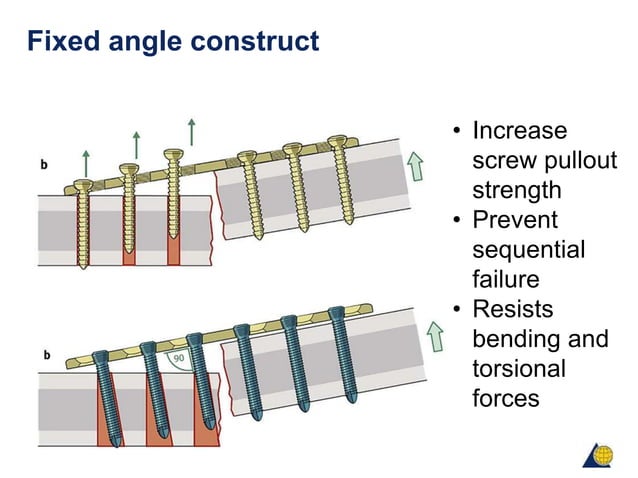 Principles of lock plate fixation AO | PPTX