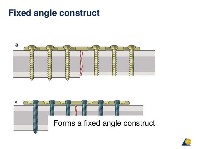 Principles of lock plate fixation AO