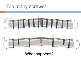 Principles of lock plates | PPTX