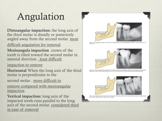 Principles of Management of Impacted Teeth Part I | PDF