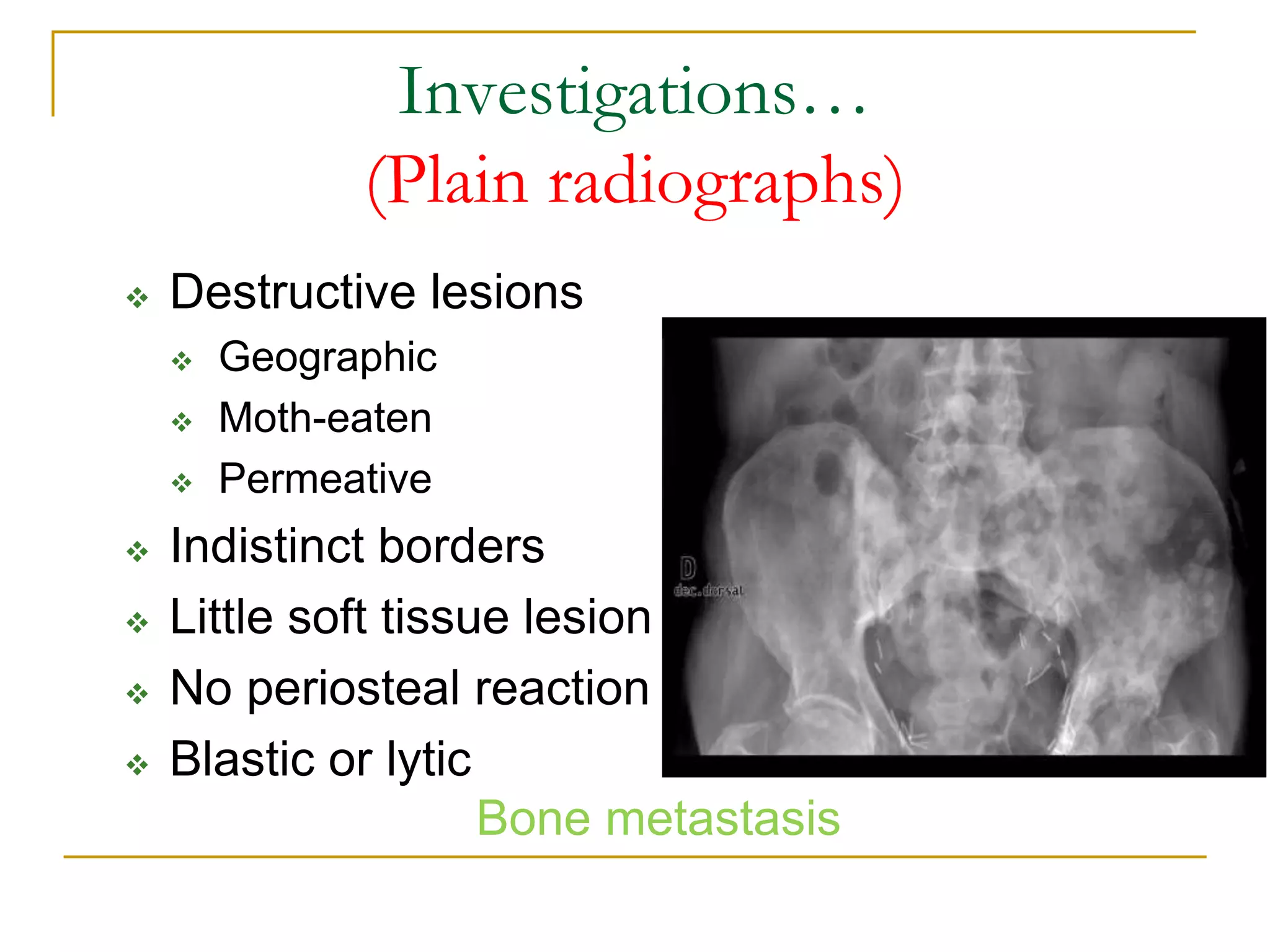Principles of management of malignant bone tumours | PPTX