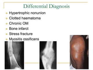Principles of management of malignant bone tumours | PPTX
