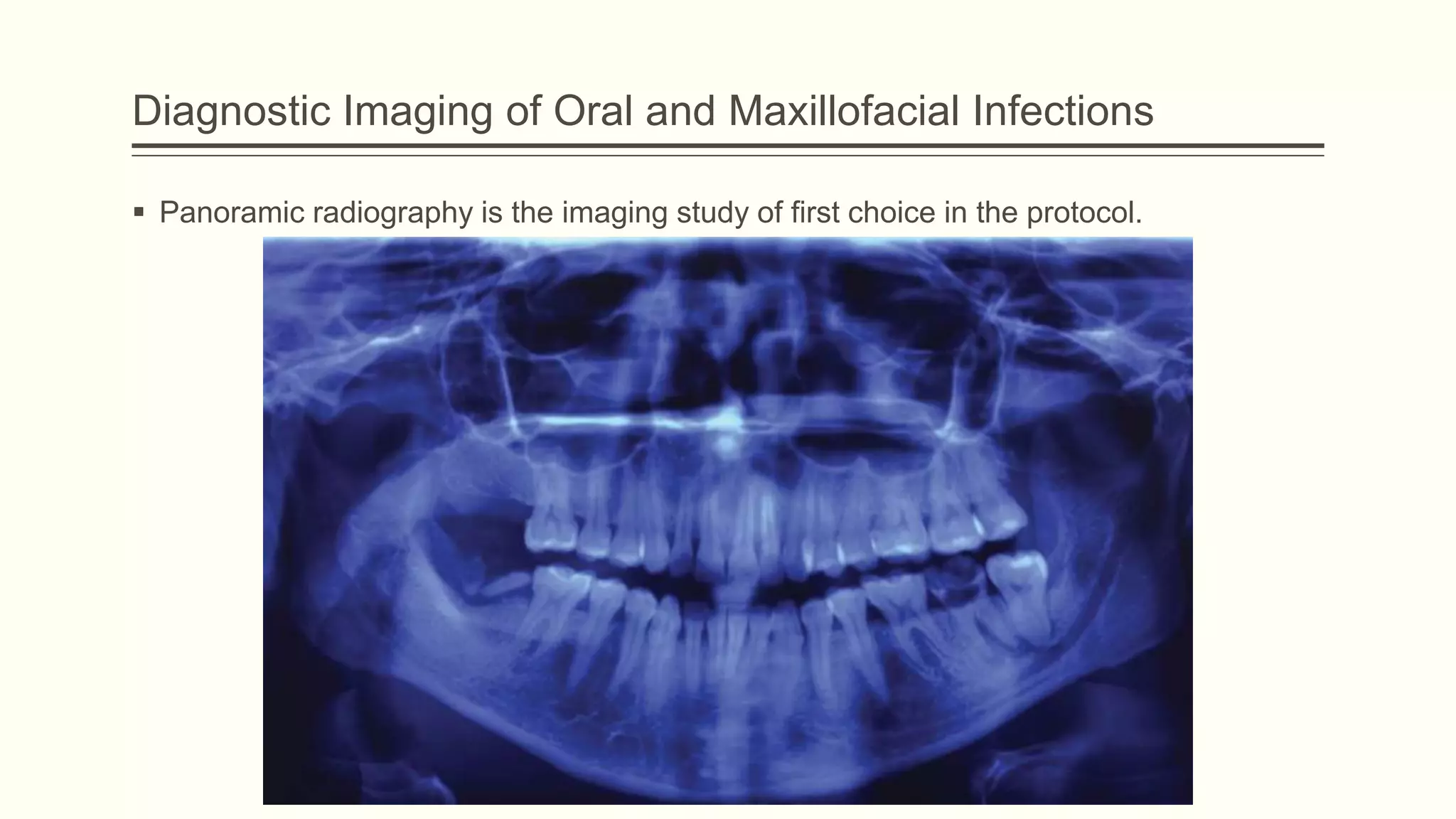Principles of Management of Odontogenic Infections.pptx